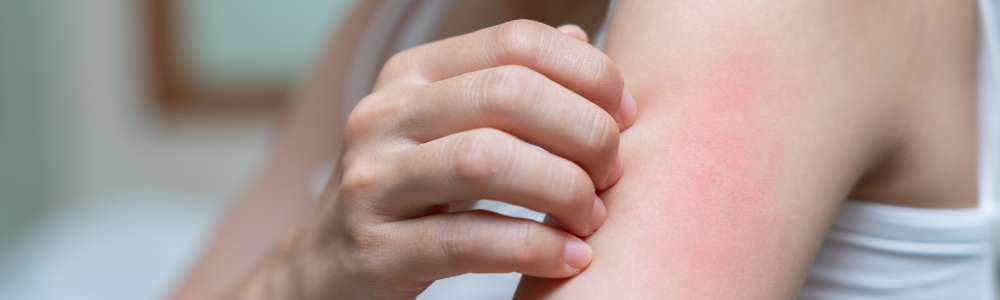 From Symptoms to Solutions: The Ultimate Guide to Skin Allergies